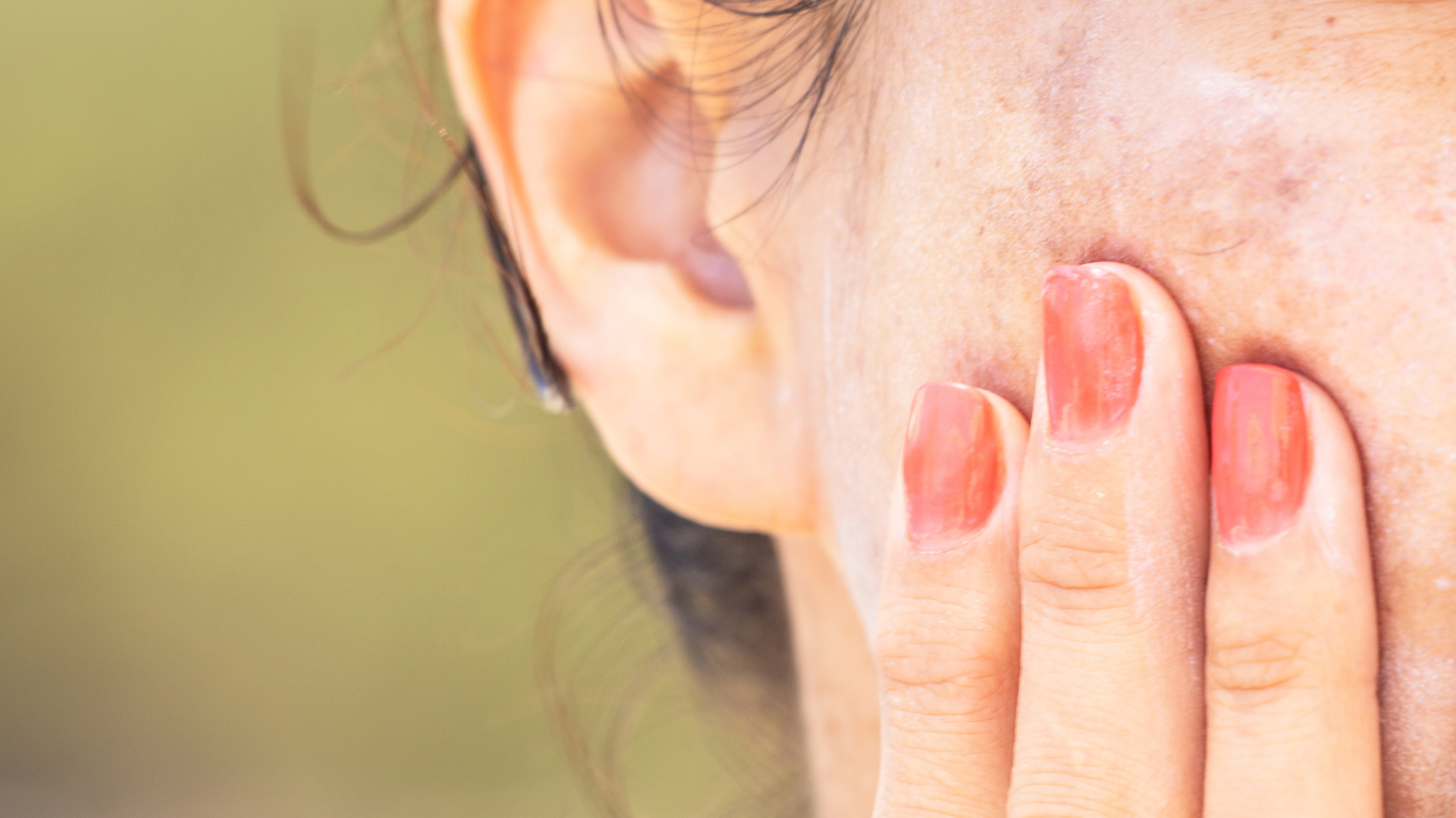 Dealing with Age Spots and Hyperpigmentation During Menopause