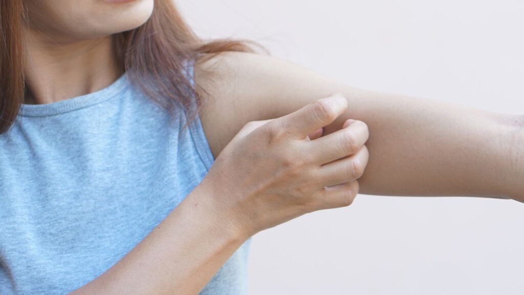 Itchiness Related to Menopause: Understanding and Managing This ...